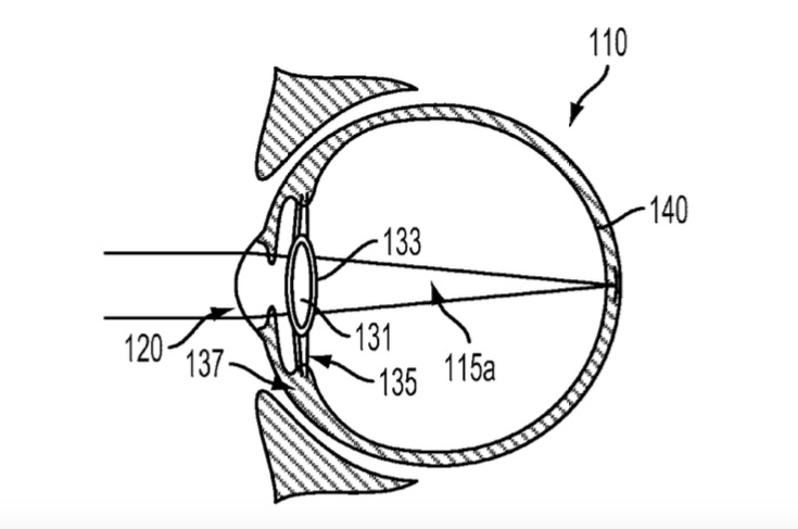 Googly eyed? Google patents a lens implant for your eyeball - Newsshooter